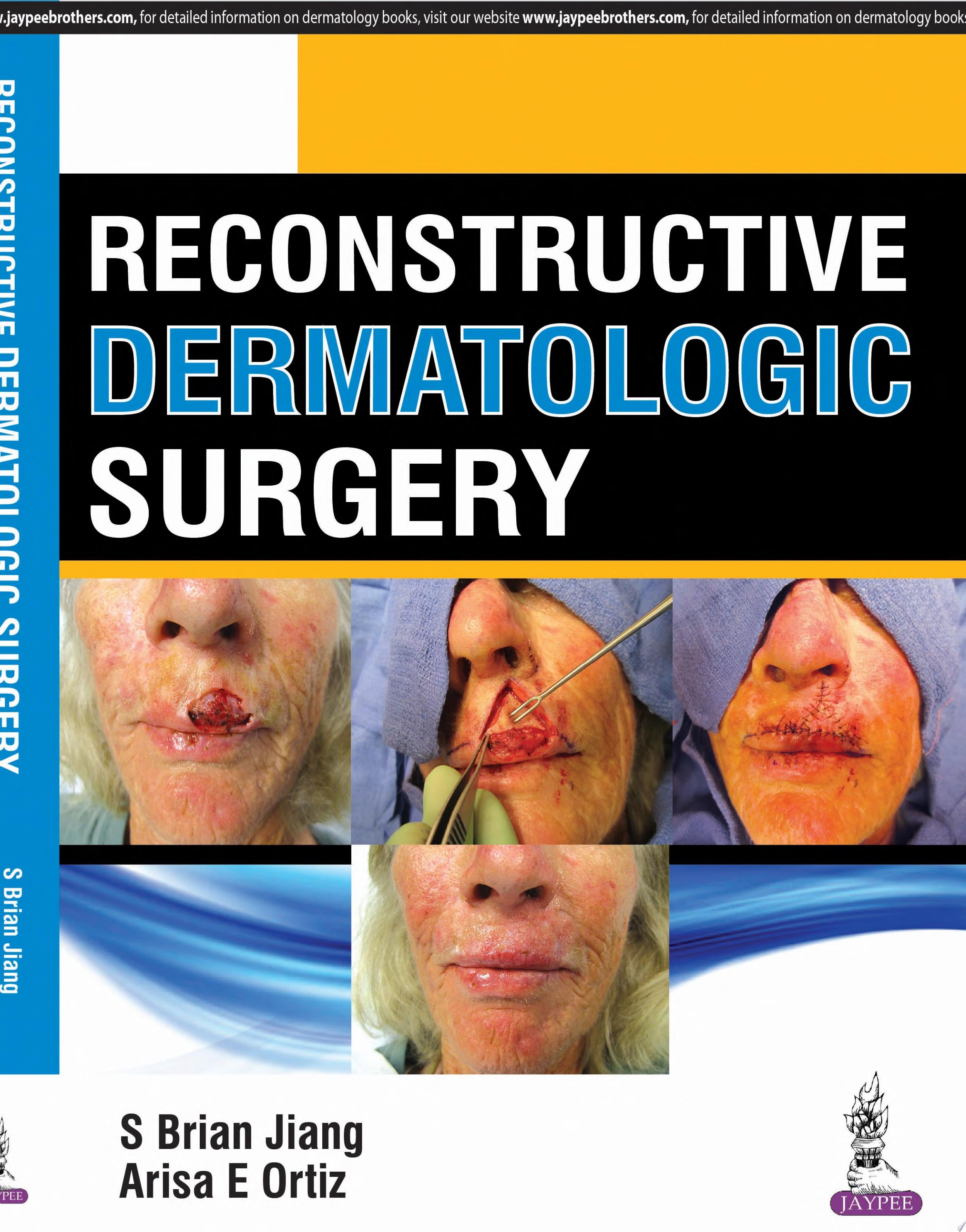 Reconstructive Dermatologic Surgery – Dermatology Library