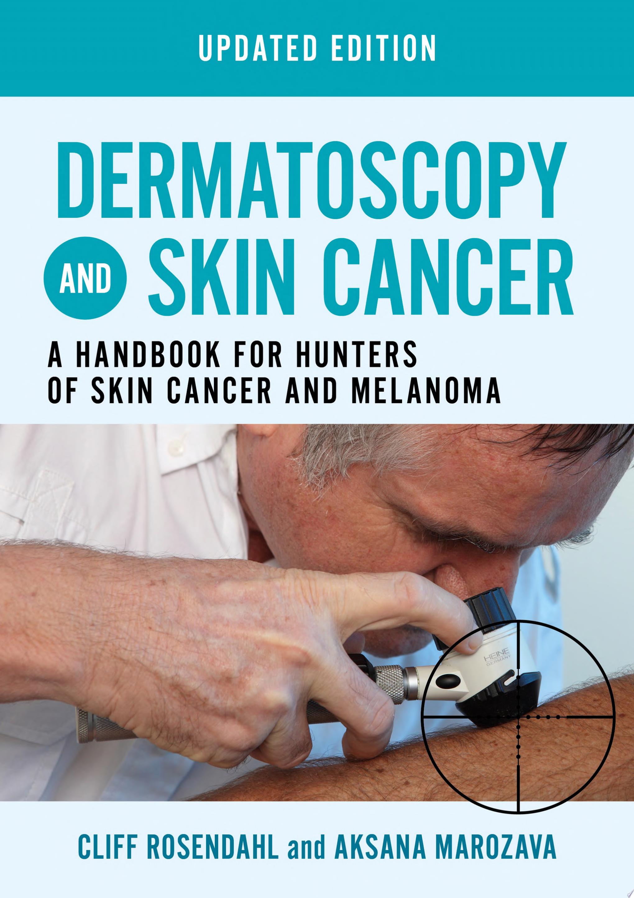 Dermatoscopy and Skin Cancer, updated edition: A handbook for hunters ...